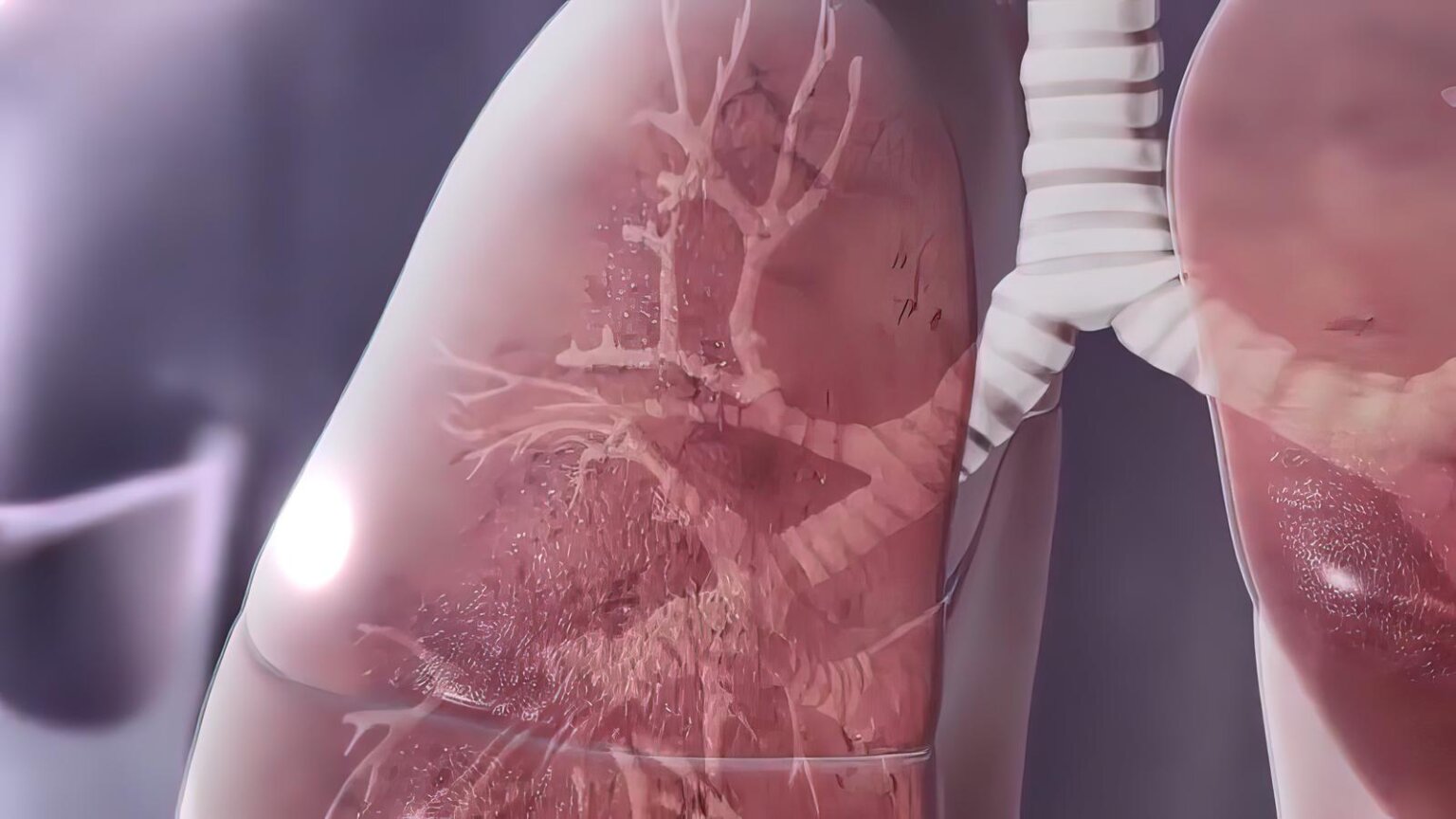 Bronchitis Causes, Symptoms, Diagnosis, Treatment Explained