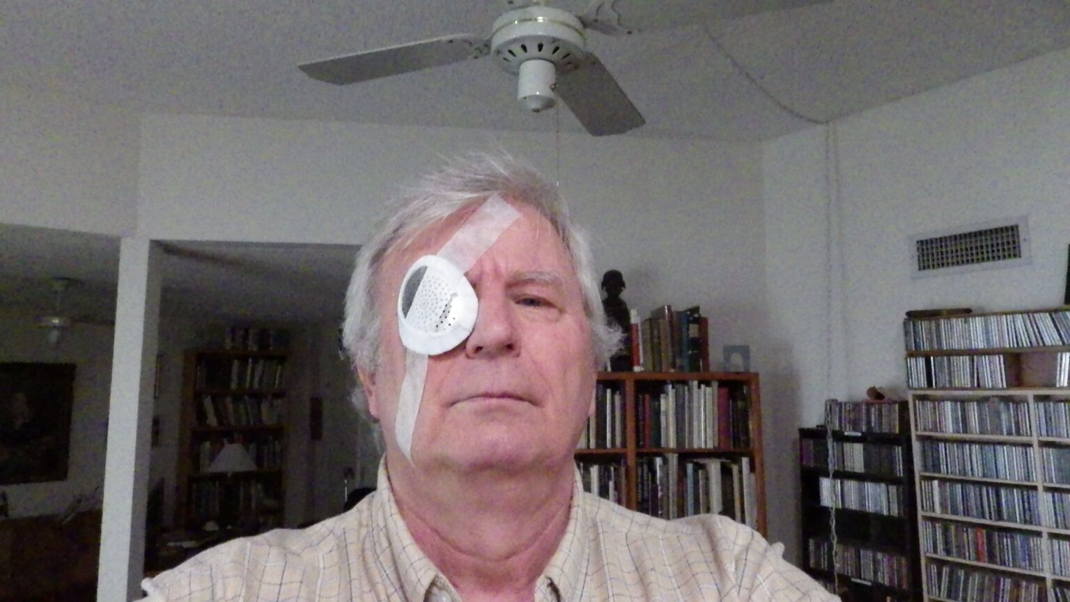 What to Expect after Glaucoma Surgery? Comprehensive Guide